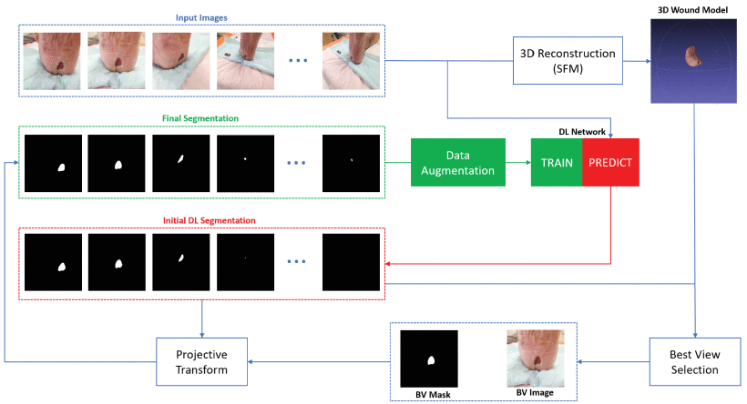 Multi-View Data Augmentation to Improve Wound Segmentation on 3D ...